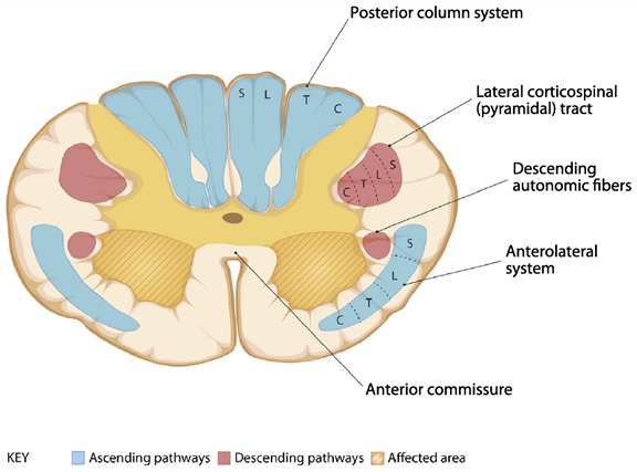 Spinal cord disorders - Dizziness-Doctor.com